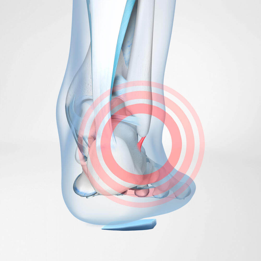 Lerne unsere CaligaLoc® kennen